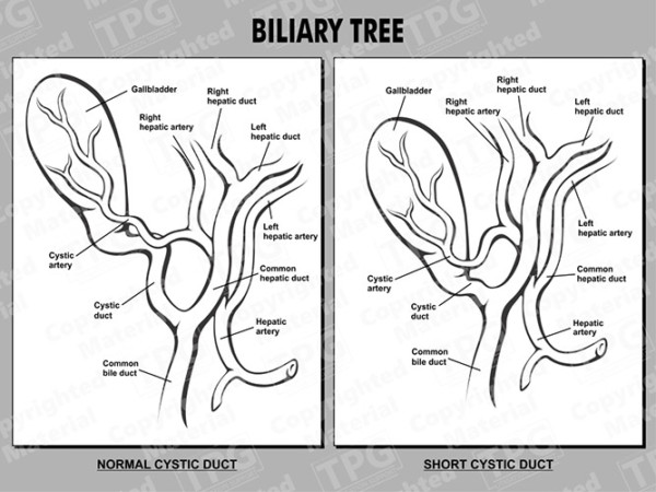 Biliary Tree - Order