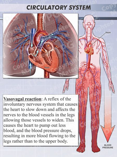 Circulatory System Vasovagal - Order